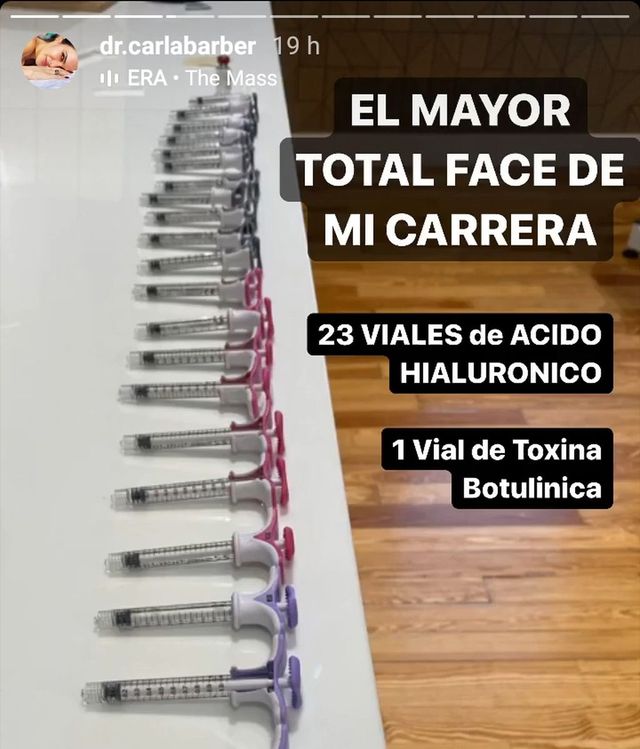 Los mejores memes sobre el último retoque estético de Kiko Matamoros ...