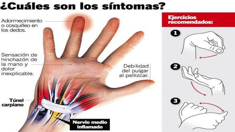 Muñeca abierta: síntomas y tratamientos - Deportes Cuatro