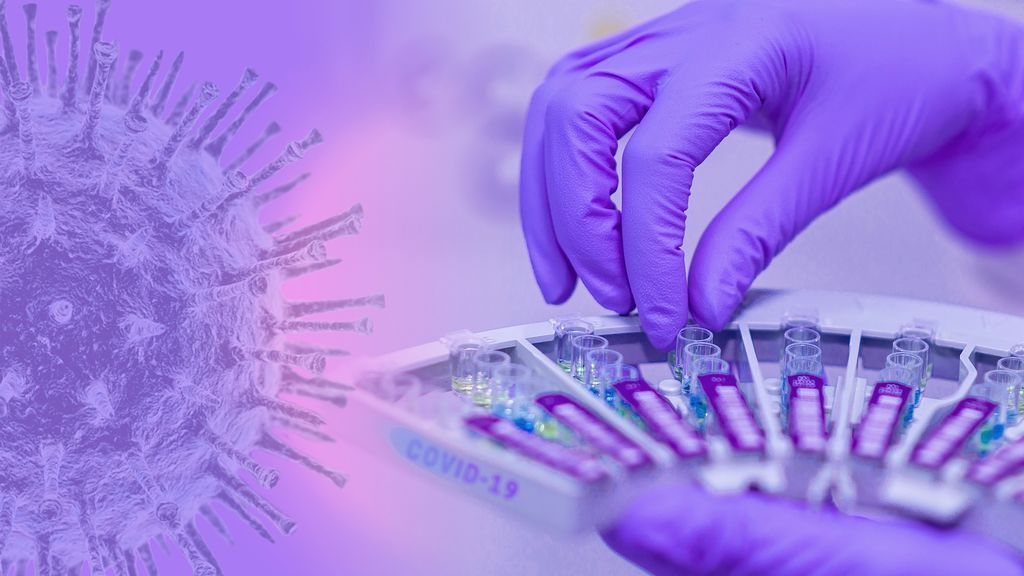 Científicos creen que el coronavirus es una sindemia: ¿Qué es y ...