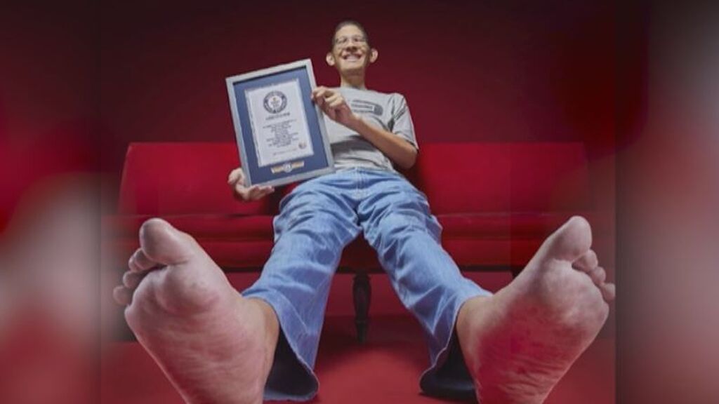 Jeison, el venezolano con los pies más grande del mundo que no para de ...