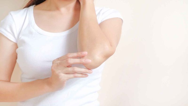 Cómo blanquear los codos de forma rápida - Divinity