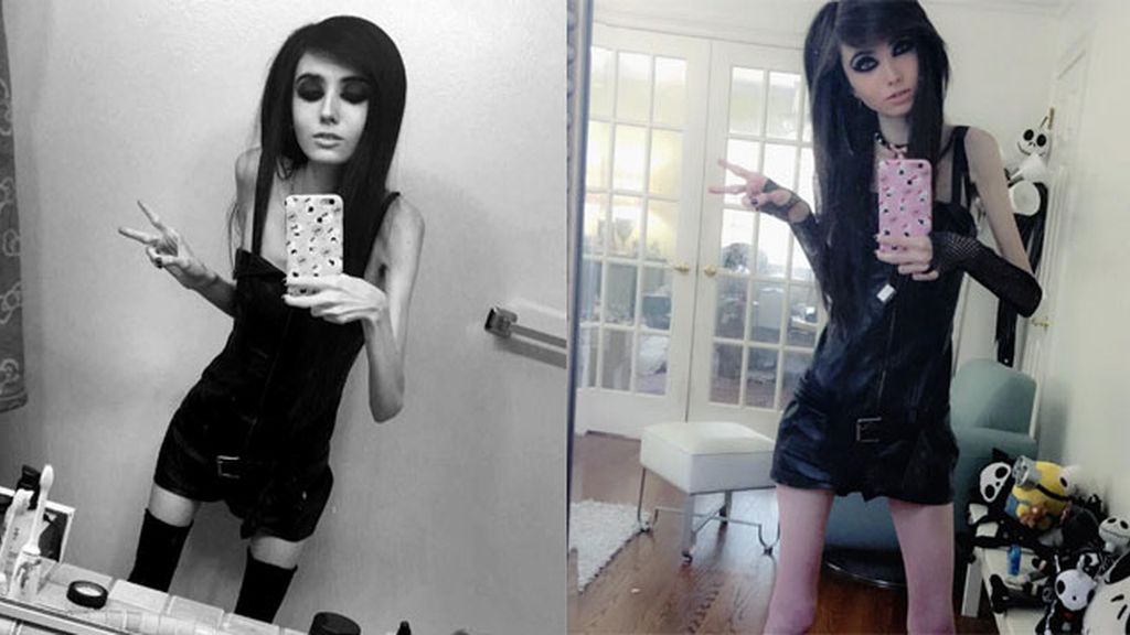 La delgadez extrema de una youtuber causa polémica en la red