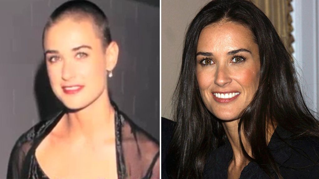 Famosas, ¿con o sin pelo?