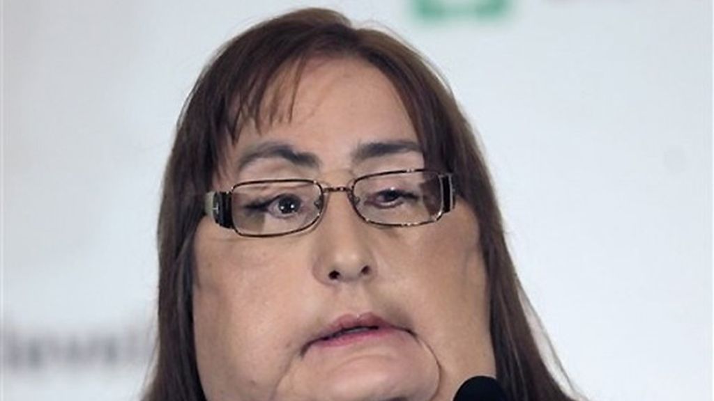 El nuevo rostro de Connie Culp