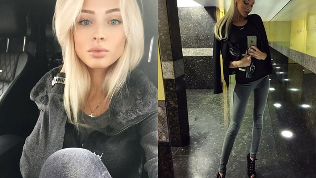 Las redes sociales, preocupadas por la salud de una modelo rusa