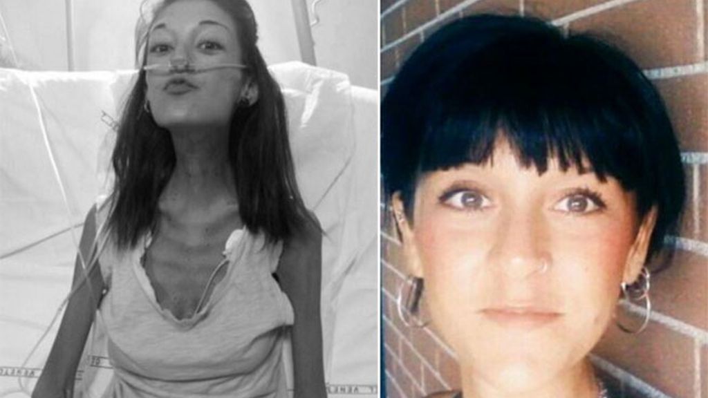 Una historia sobre la anorexia: Cómo la superó para salvarse y ayudar a ...