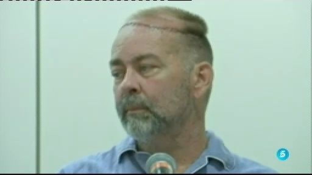 Un hombre se somete al primer trasplante de cráneo y cuero cabelludo