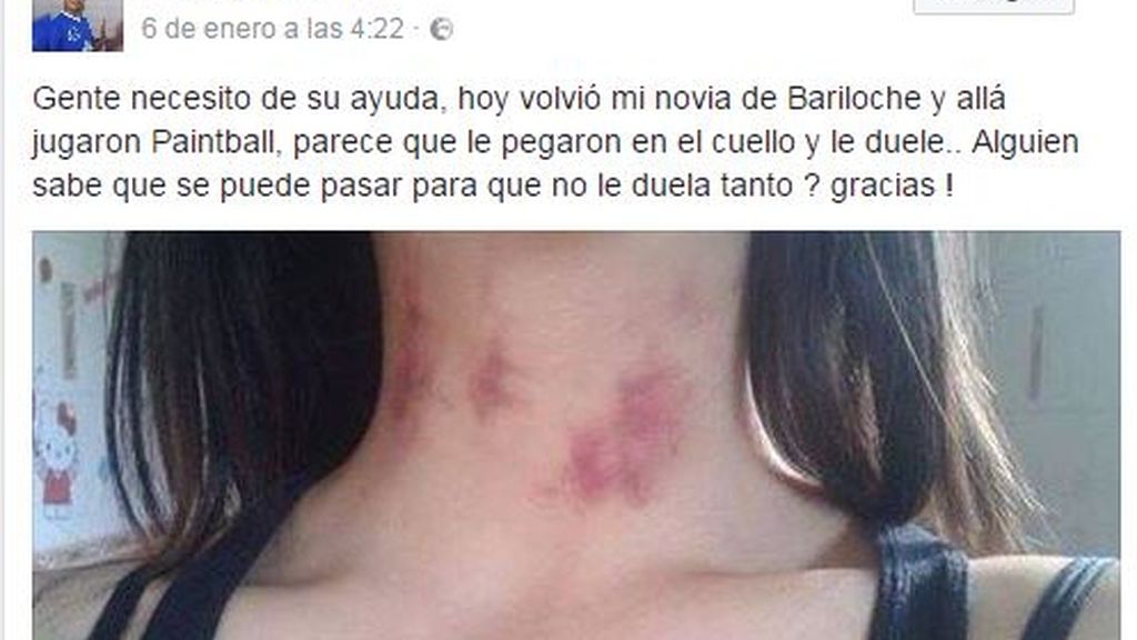 Un joven pide ayuda para los moratones de su chica cuando en realidad ...