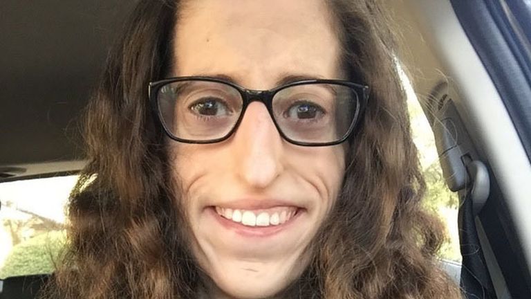 El asombroso caso de Abby Solomon: nunca tiene hambre pero no puede dejar de comer