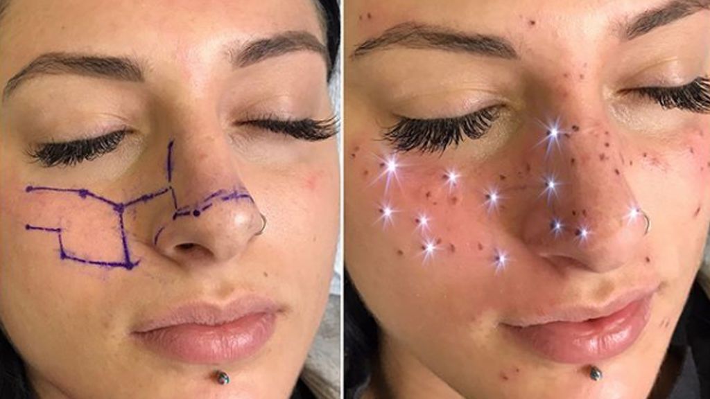‘AstroFrecks’, la nueva moda de tatuarse una constelación en la cara
