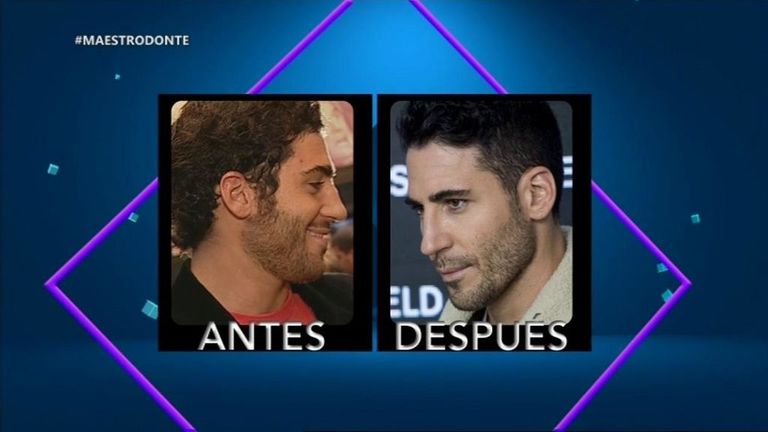 Cazamariposas | ¿Ha habido retoques? El rostro de Miguel Ángel ...