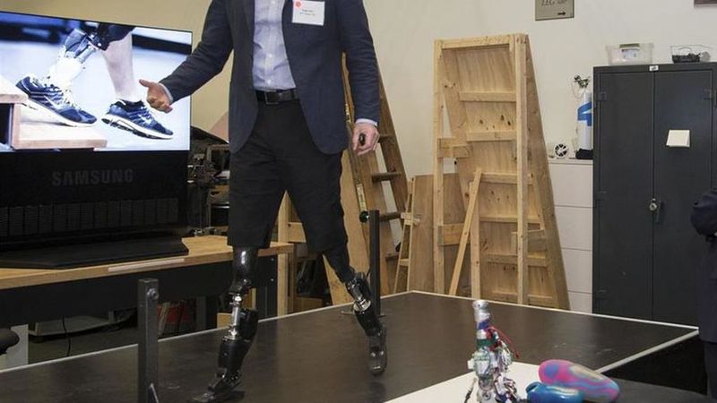 Las prótesis e implantes inteligentes abren la puerta a nuevas ...