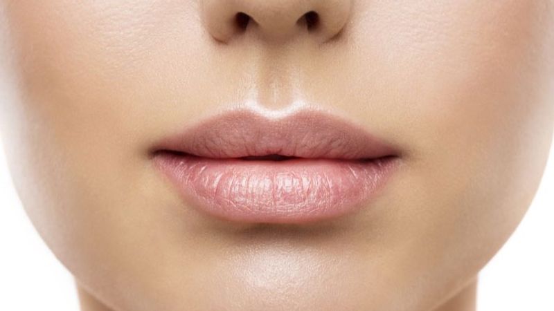 ¿Cómo distinguir si un relleno de labios está mal hecho? - Divinity