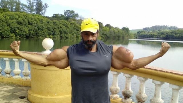 Muere el conocido como 'Hulk brasileño' al sufrir un paro cardíaco