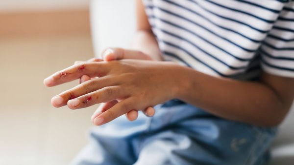 Usos del mentol que te sorprenderán