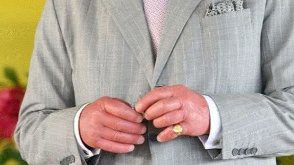 Preocupación por los dedos rojos e hinchados de Carlos III