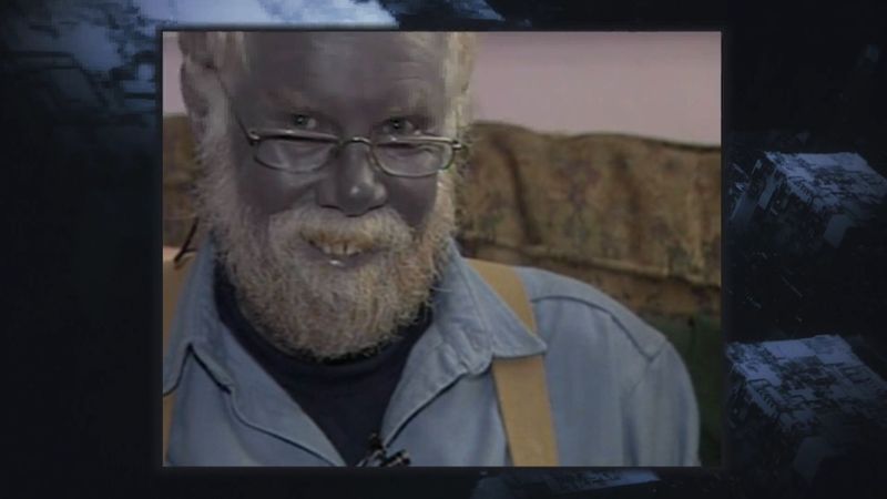 ¿Por qué hay personas con la piel azul? - Futura