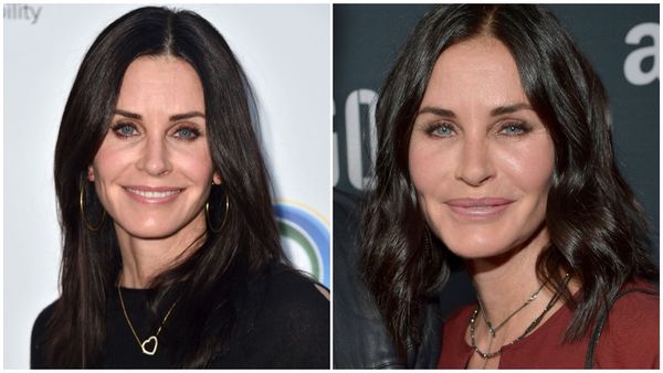 Famosas con bótox: el antes y el después del tratamiento - Divinity