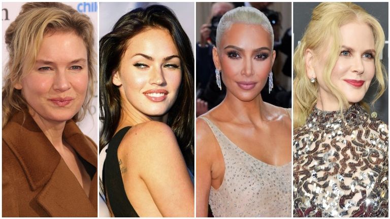 Famosas con bótox: el antes y el después del tratamiento - Divinity