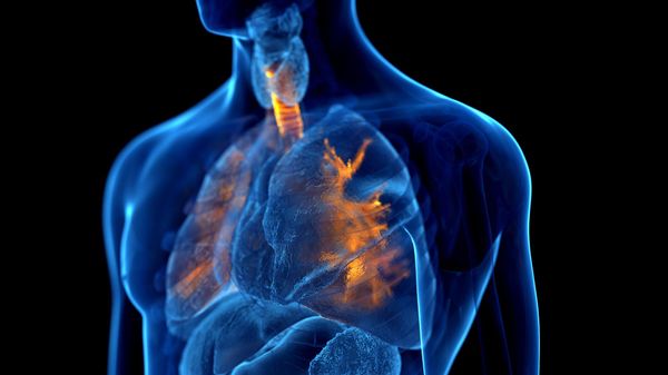 Síntomas de la bronquitis: qué es y cómo diferenciarla de una neumonía