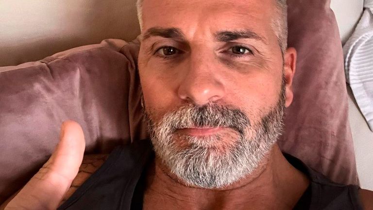 Carlos Alba muestra la cicatriz de su reciente operación de corazón ...