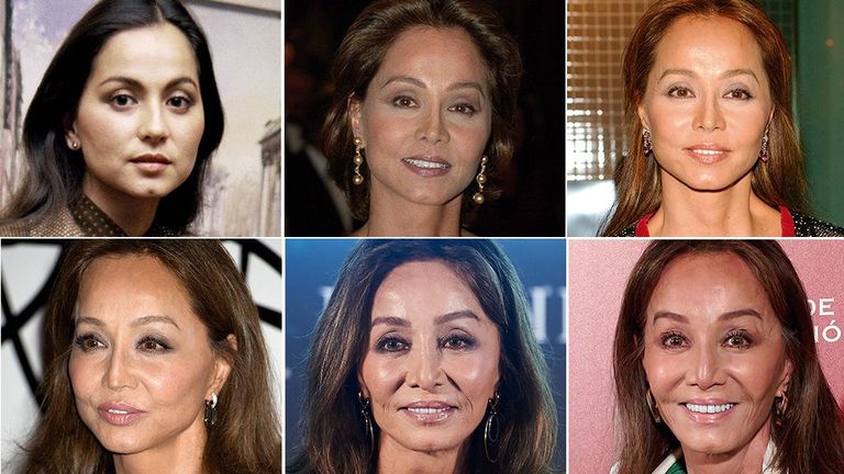 Isabel Preysler, su cambio desde joven, con tres operaciones de nariz ...