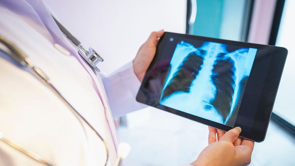 Día contra el Cáncer: diferencias entre avanzado, metastásico y ...