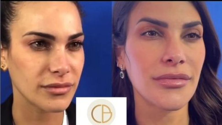 Carla Barber: el antes y el después de su rostro tras cinco años de ...