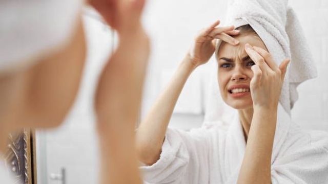 Acné en adultos: los tres casos en los que debes consultar al dermatólogo