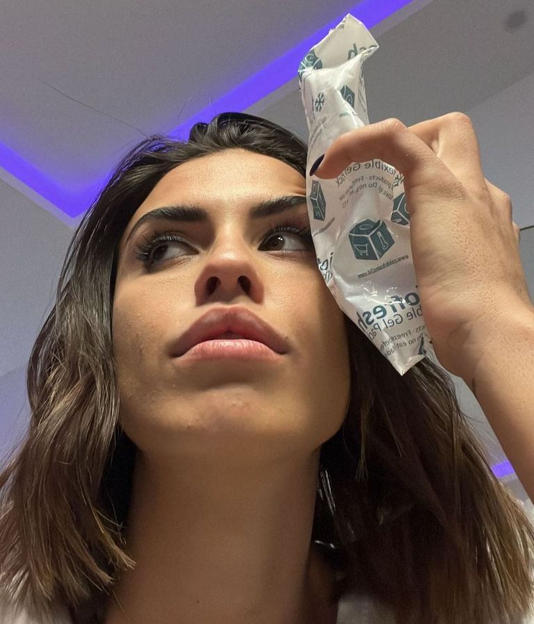 Sofía Suescun enseña su párpado deformado tras un accidente con su perro - Gran Hermano