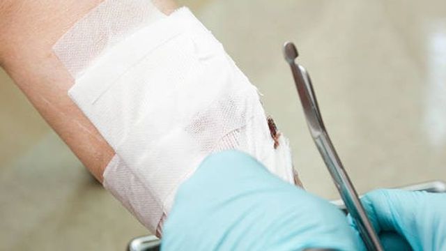 ¿Qué es un absceso y cómo tratarlo?