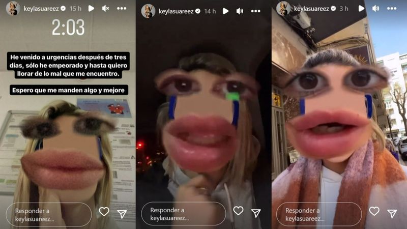Keyla Suárez comparte su diagnóstico médico tras acudir a urgencias ...