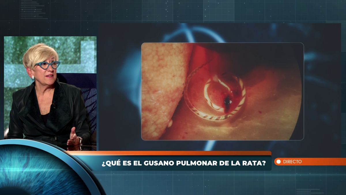 Alerta por las plagas de ratas: su gusano pulmonar amenaza con ...
