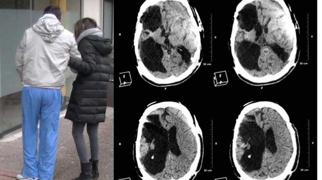 Foltra, la clínica gallega pionera en un tratamiento con hormonas del ...