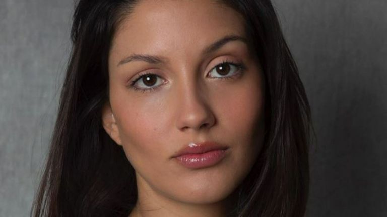 Tania Medina enseña las pronunciadas varices que tiene en las piernas ...