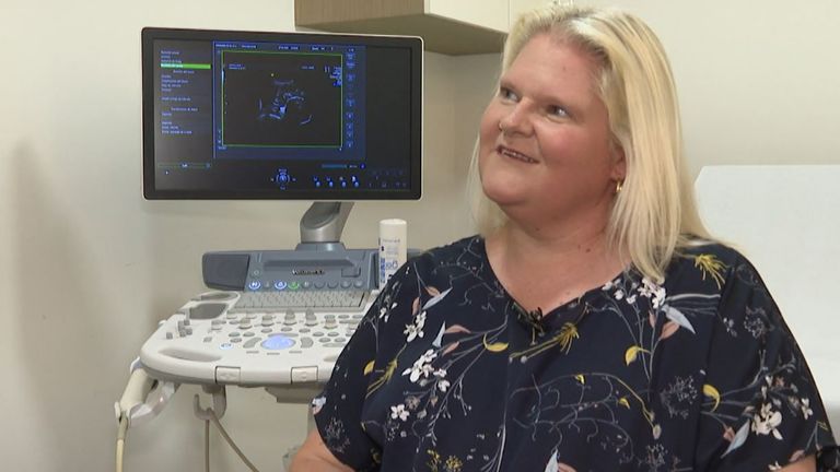 Louise Brown, la primera bebé que nació por fecundación in vitro