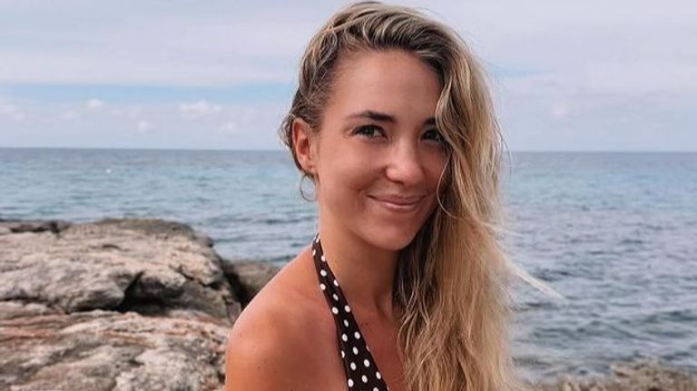 Alice Campello enseña la secuela física que sufre cinco meses después ...