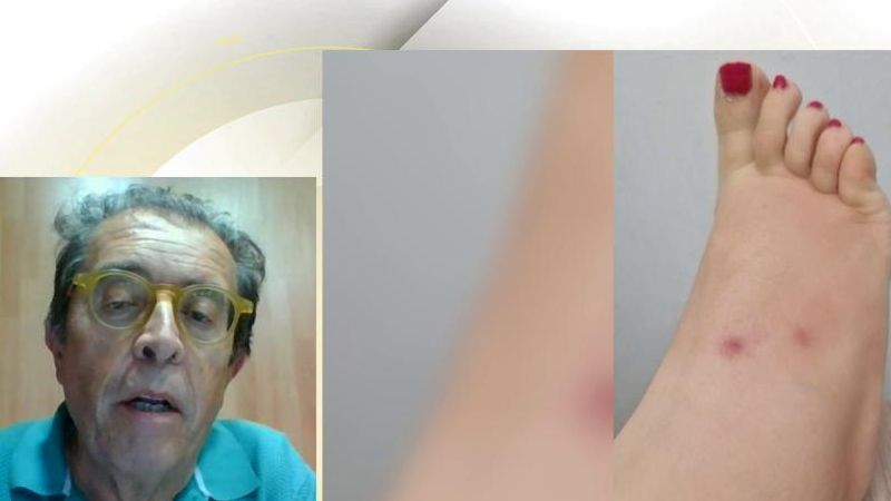 Pistas para identificar qué insecto te ha picado y saber qué remedio ...