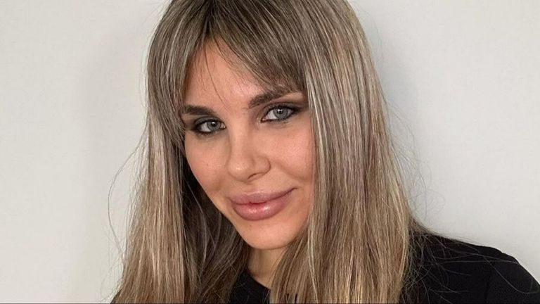 Ivana Icardi revela el verdadero motivo por el que se retoca la cara ...