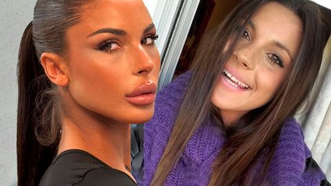 Alba Casillas: todas sus operaciones y retoques estéticos - La isla ...