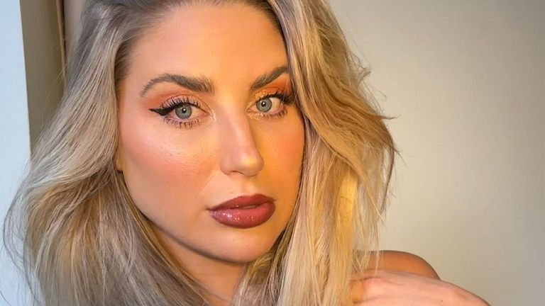 La impactante foto de Susana Bianca con "la cara quemada" - GH VIP