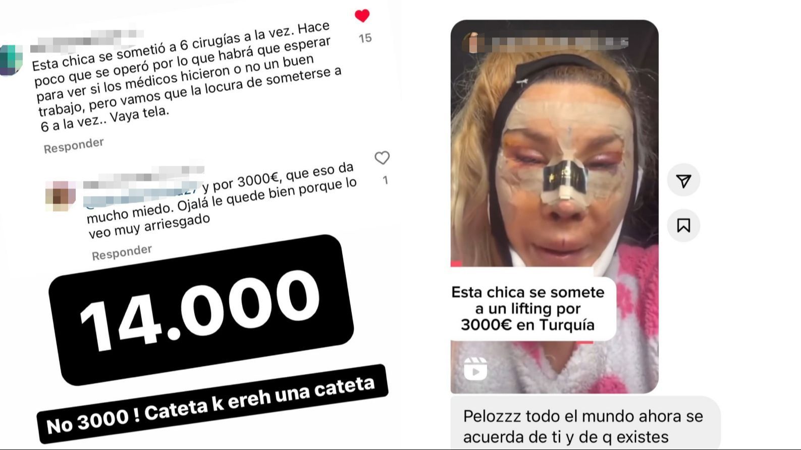 La Pelopony revela cuánto dinero le ha costado la operación en Turquía