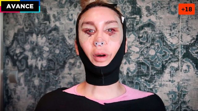 Avance | La nueva cara de La Pelopony, mañana en exclusiva en mtmad