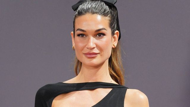 Estela Grande: el antes y el después de su nueva sonrisa - GH VIP