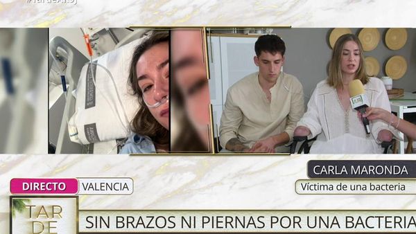 La dura historia de Carla Maronda, sin brazos ni pies a causa de una ...