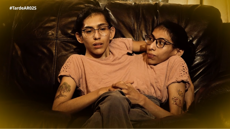 Carmen y Lupita, la historia de dos siamesas que viven unidas por el torso - Tardear