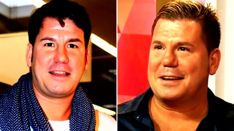 Lucas, del grupo Andy y Lucas, desmiente que se haya operado la cara ...