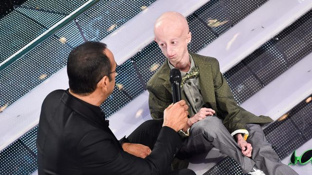 Muere Sammy Basso, el italiano que visibilizó el síndrome que le ...