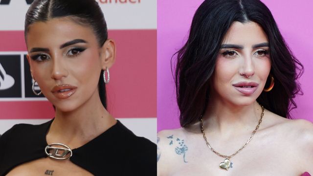 Naiara OT, ¿se ha operado la nariz? Una cirujana plástica analiza su ...