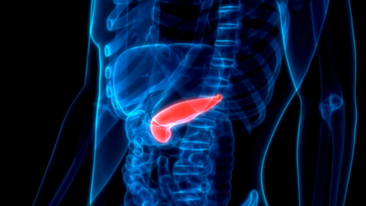 El cáncer de páncreas, el tumor más letal y más difícil de diagnosticar